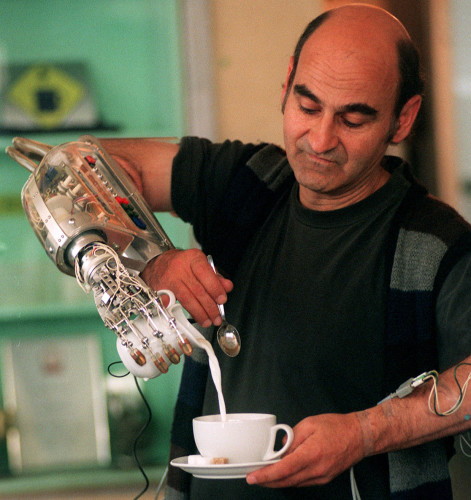 This guy wants to broadcast online from the ear he’s been growing on ...